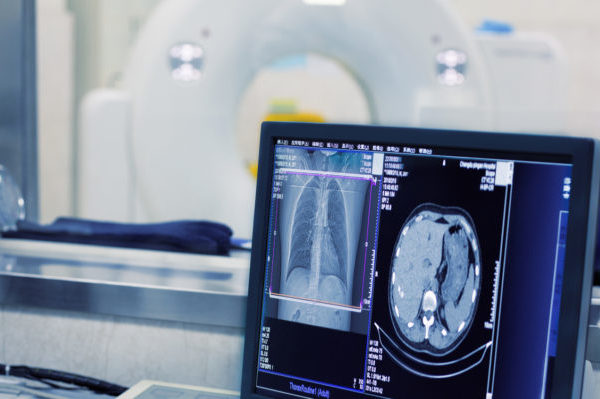 ΑΞΟΝΙΚΗ ΤΟΜΟΓΡΑΦΙΑ - Απεικονιστική Πάρου